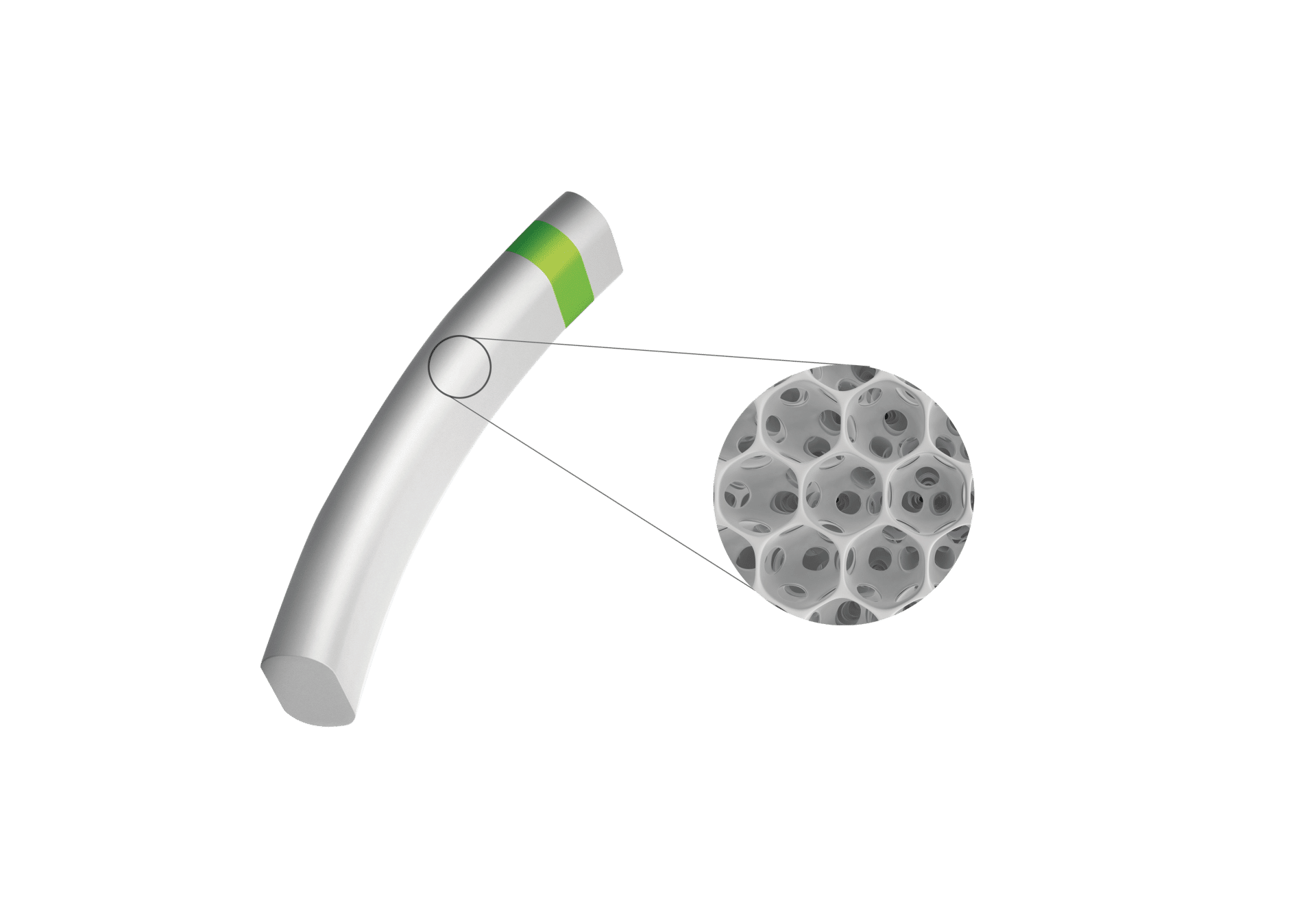 iSTAR Medical Expands Commercial Rollout of MINIject with First ...