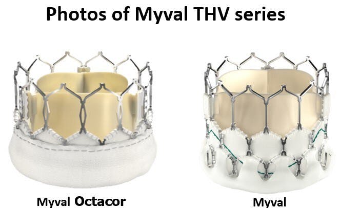 Meril’s Myval Devices for TAVR Evaluated at 1 Year in LANDMARK RCT ...