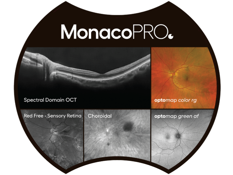 Optos Unveils MonacoPro Ultra-Widefield and OCT Retinal Imaging ...