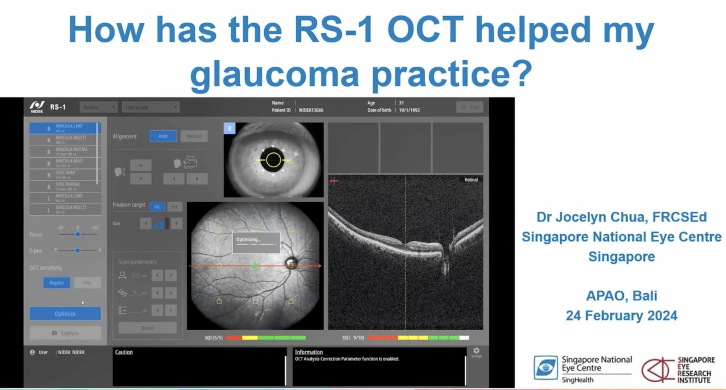 How Has the RS-1 OCT Helped My Glaucoma Practice? - Eyetube