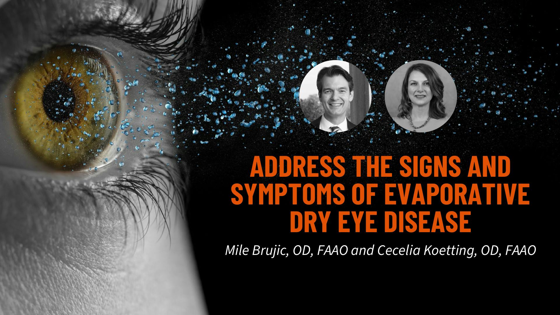 Evaporative Dry Eye Treatment at Zane Stirling blog