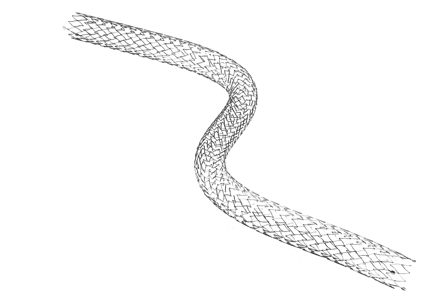 Optimed’s Tentos 4-F Stent System Launched in Europe and Other CE Mark Countries - Endovascular ...