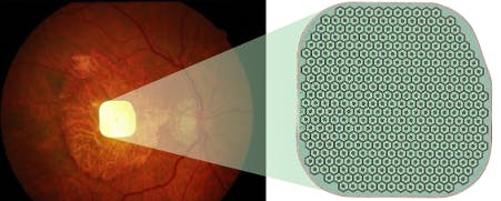 NEJM Publishes Study Demonstrating Vision Restoration with Brain ...