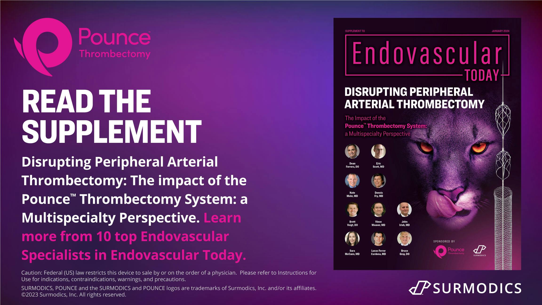 Transitioning From Aspiration to the Pounce™ Thrombectomy System for ...