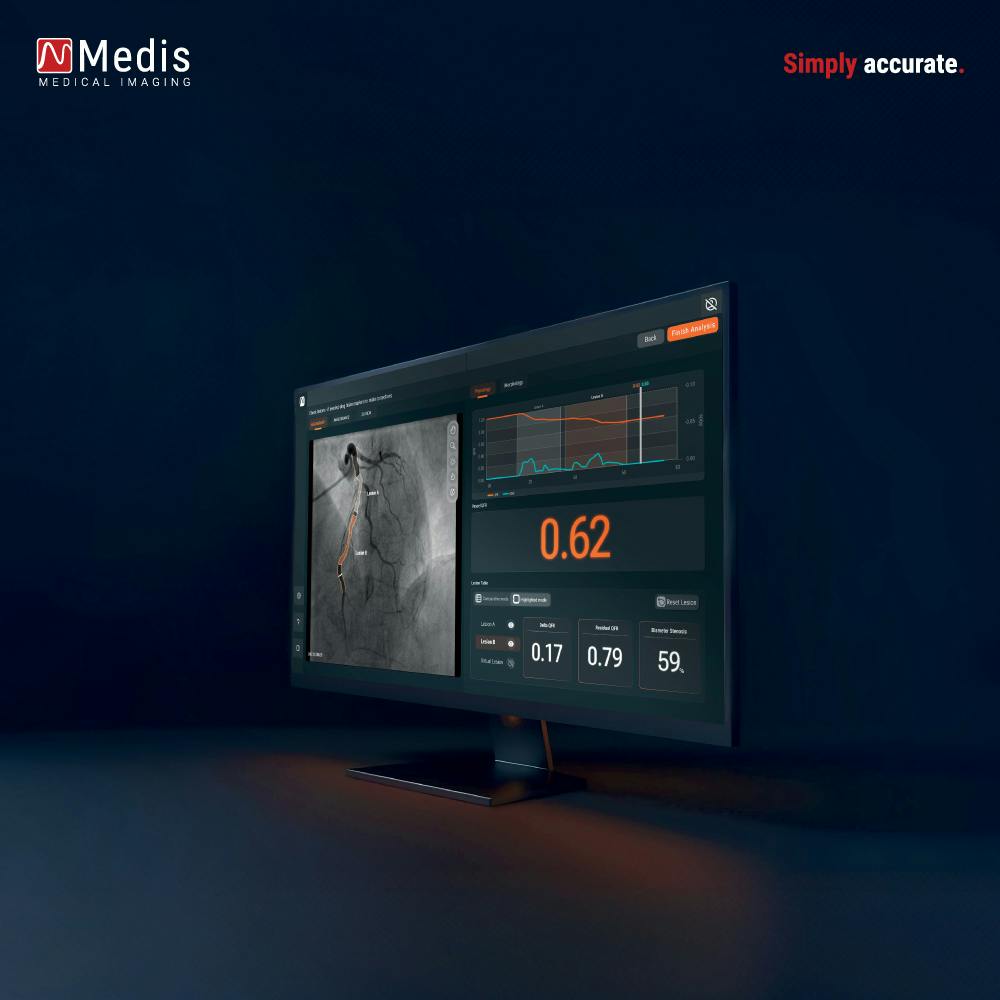 GE and Medis Collaborate on Noninvasive Coronary Assessments for CAD ...