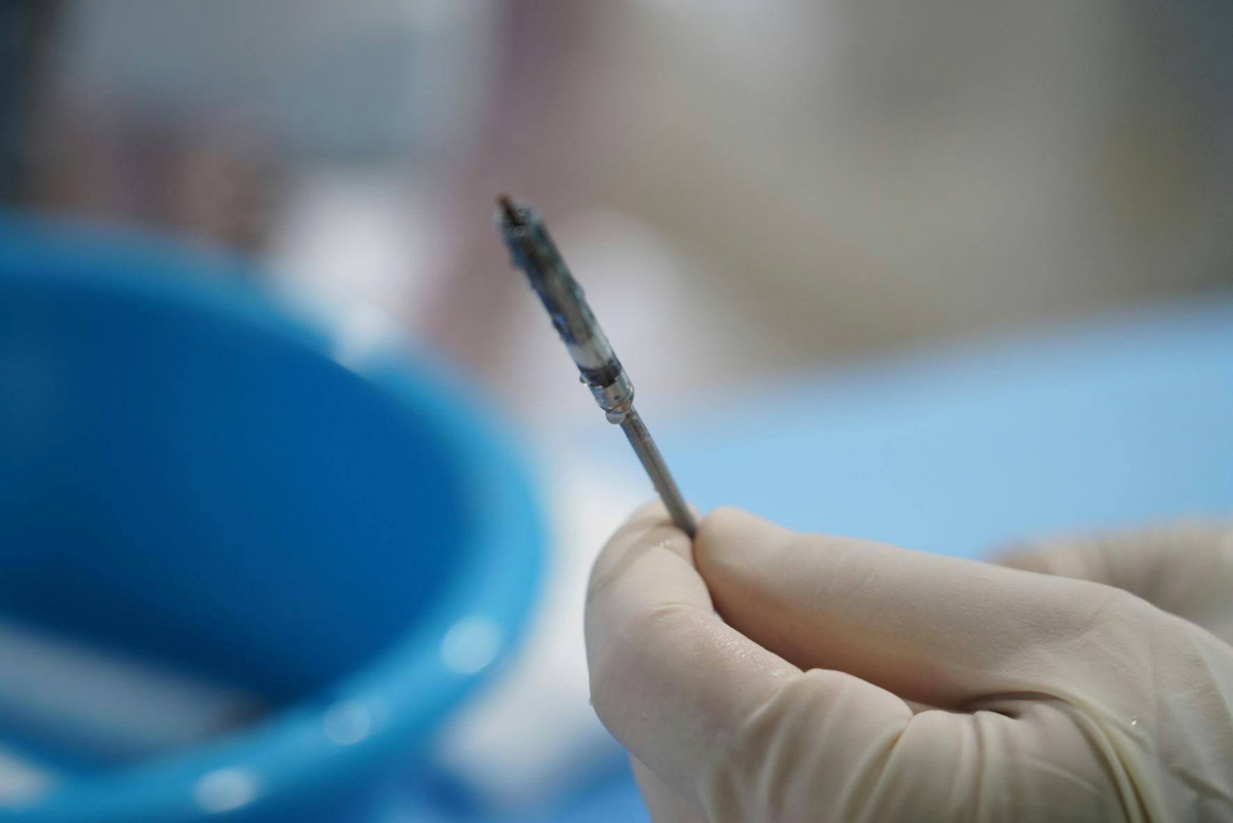 Restore Medical’s ContraBand Implant Evaluated to Treat Chronic Left ...