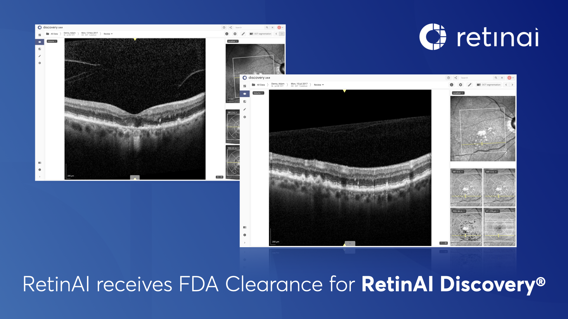 RetinAI Receives FDA Clearance for Discovery Image Management Platform ...