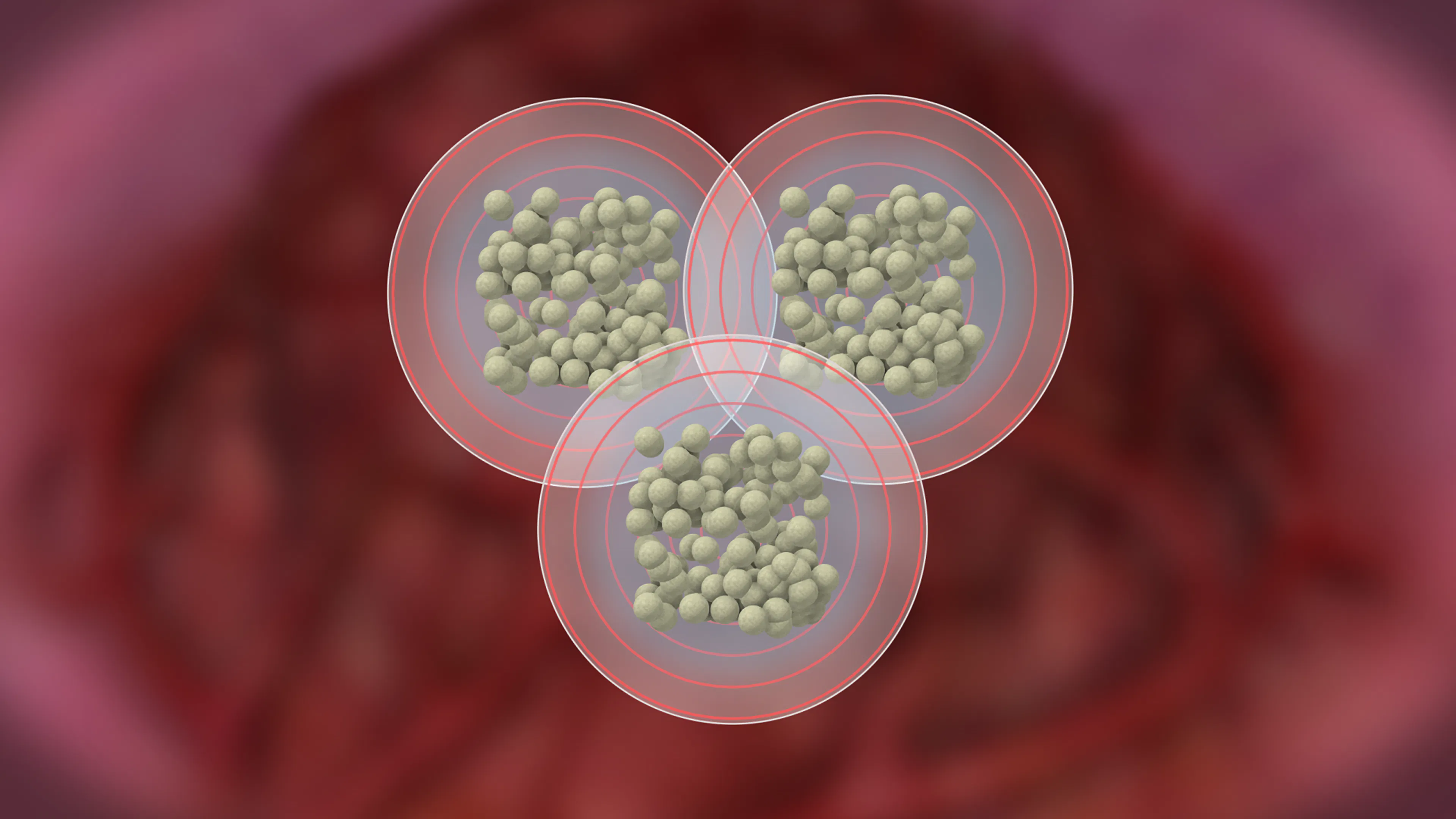 NASIR-HCC Study Evaluates Nivolumab Use Following Sirtex Medical’s SIRT ...
