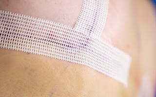 Meet Sylke, the First Wound Dressing Made of Pure Hypoallergenic Silk ...