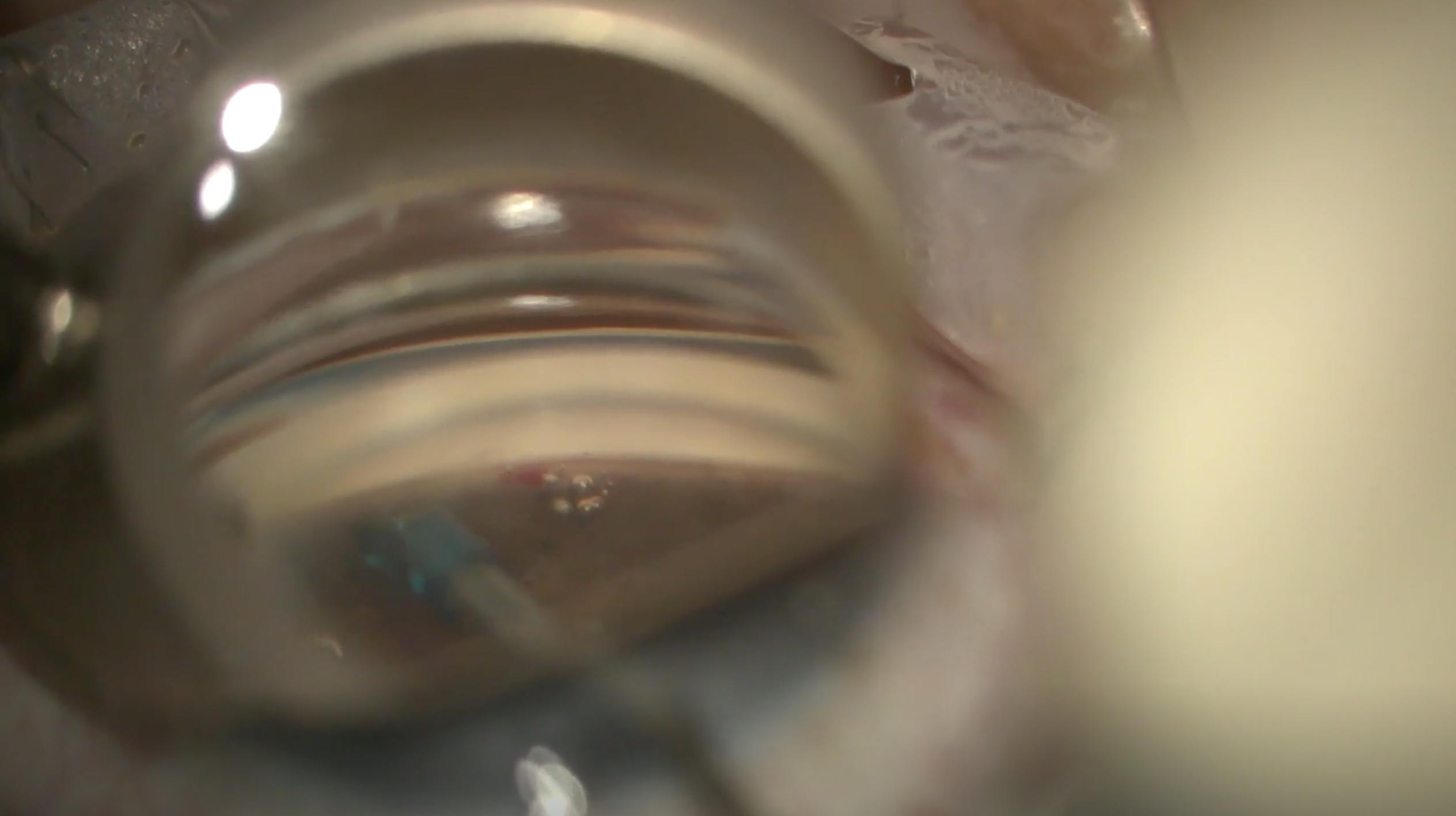 Streamline Surgical System - Eyetube