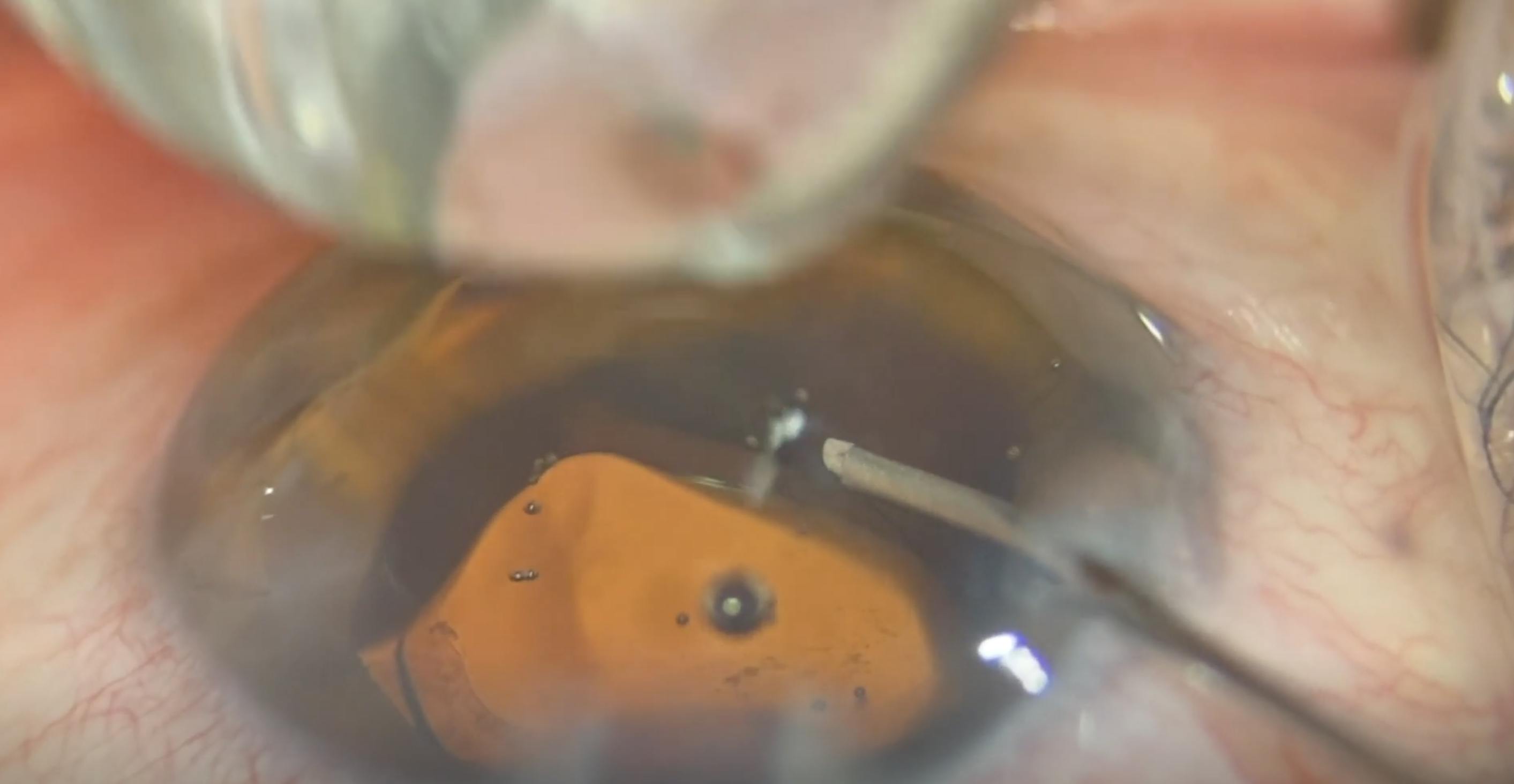 iTrack Advance Training Video - Eyetube