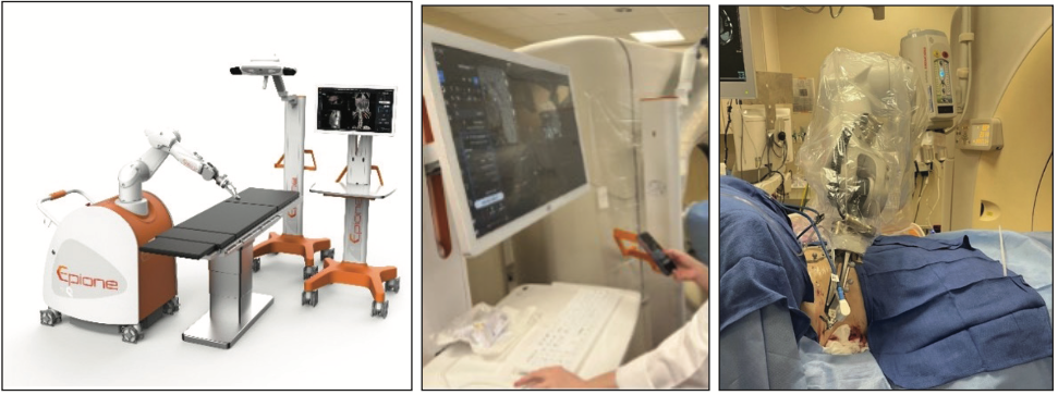 Robotics in Interventional Oncology: The Next Frontier in Image-Guided ...