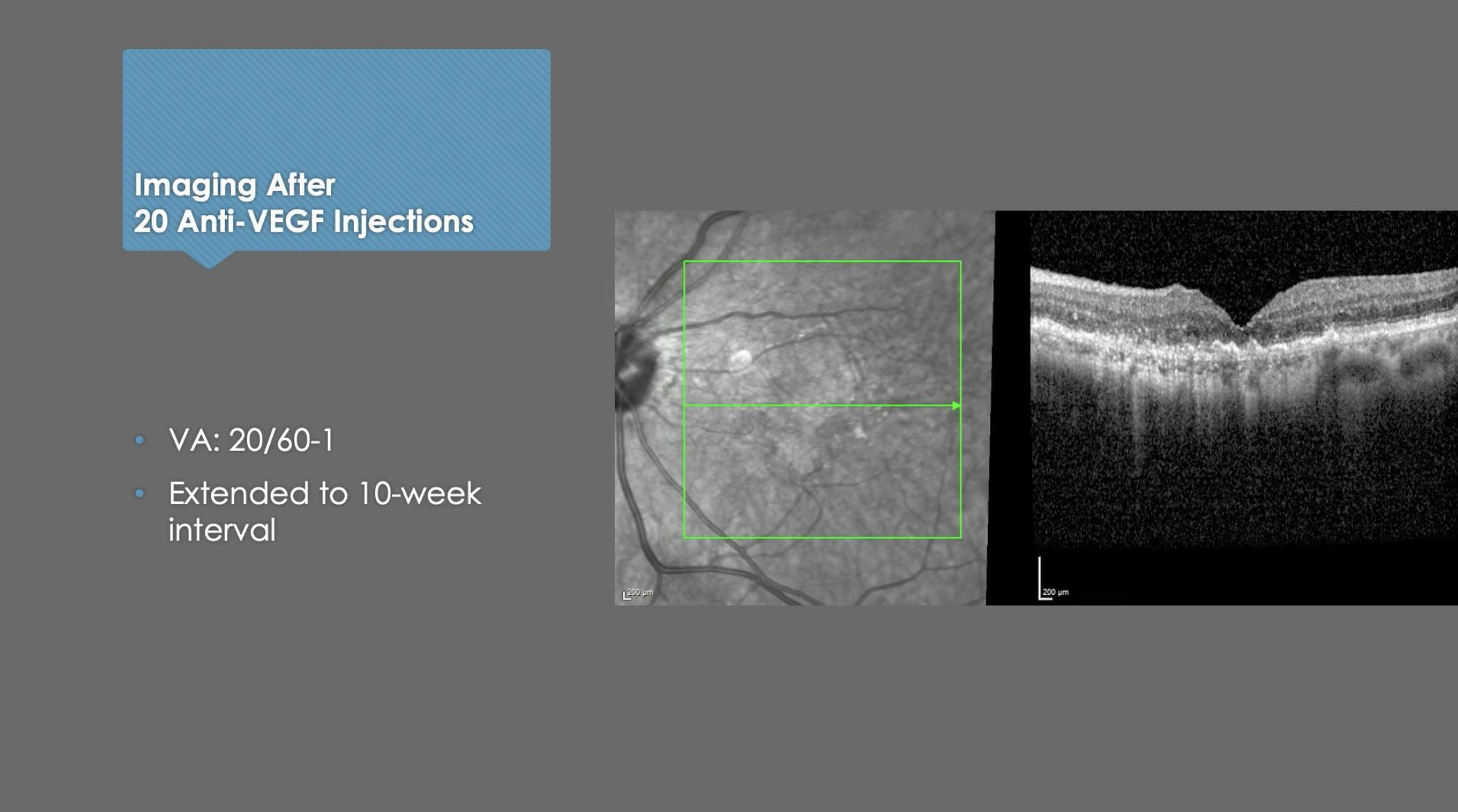 Switch Case: Massive PED (Part 1) - Eyetube