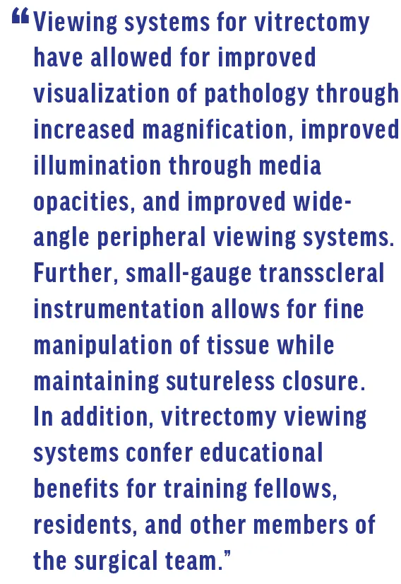 Scleral Buckle Placement Using Chandelier Illumination for a Macula ...