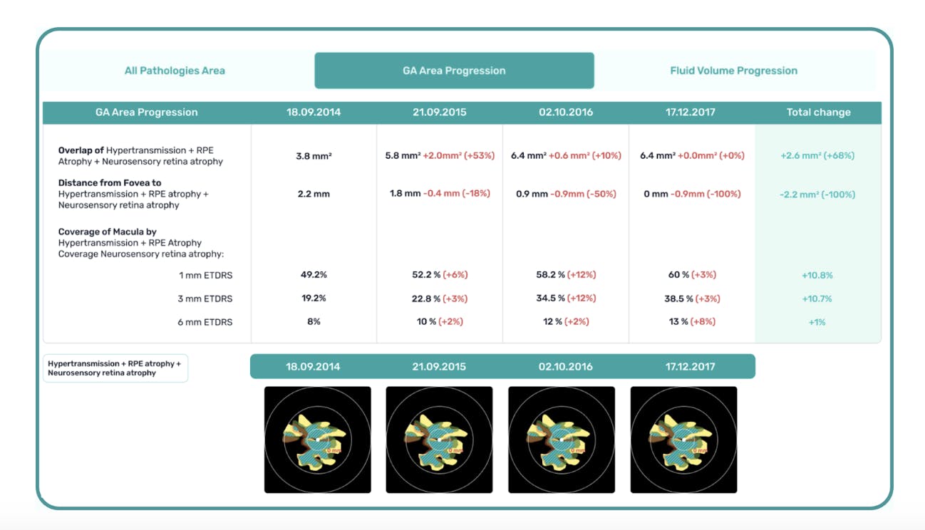 Altris AI Introduces AI-Powered Fluid and GA Quantification Features ...