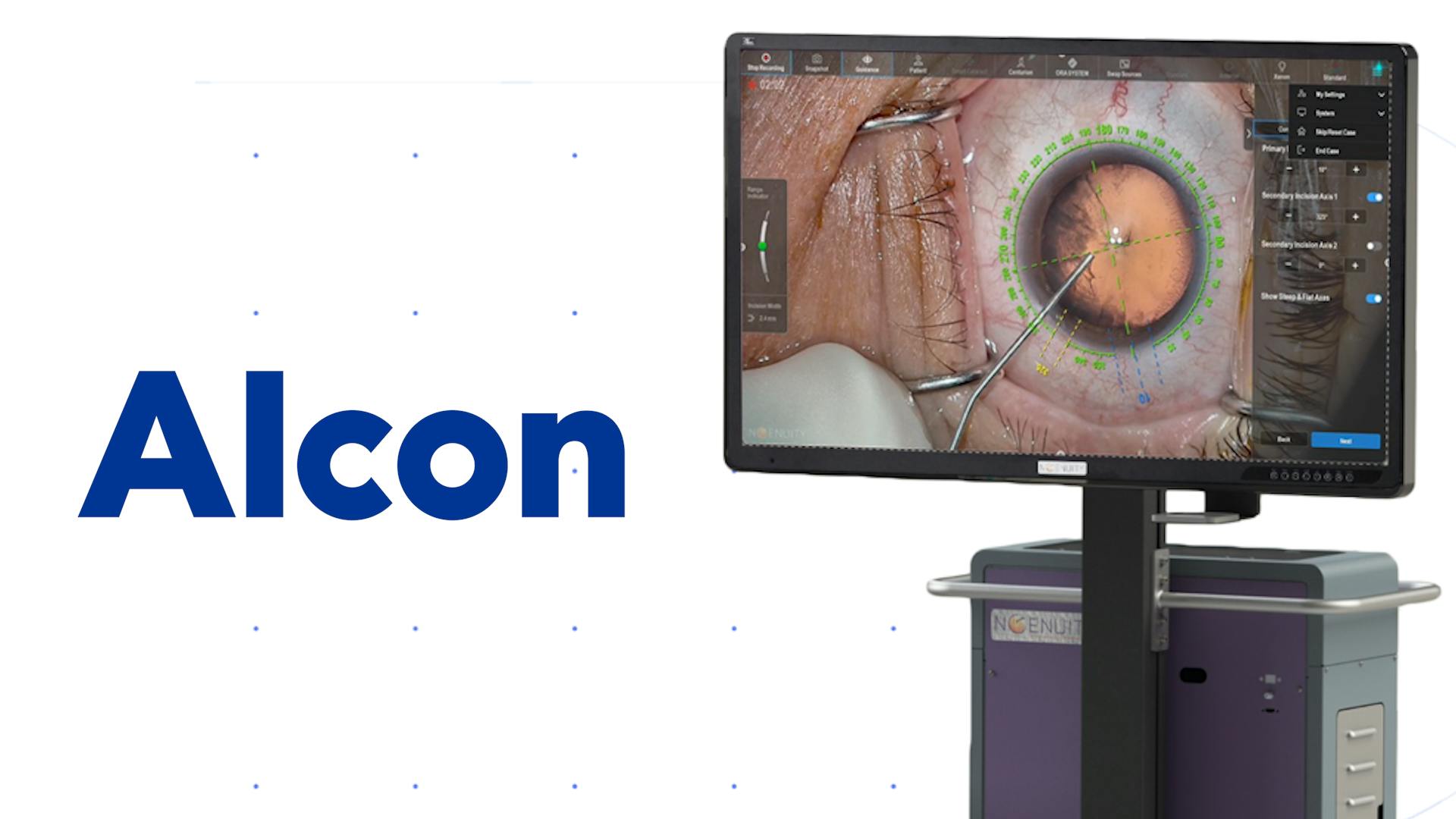 Alcon Ngenuity 1.5 - Eyewire+