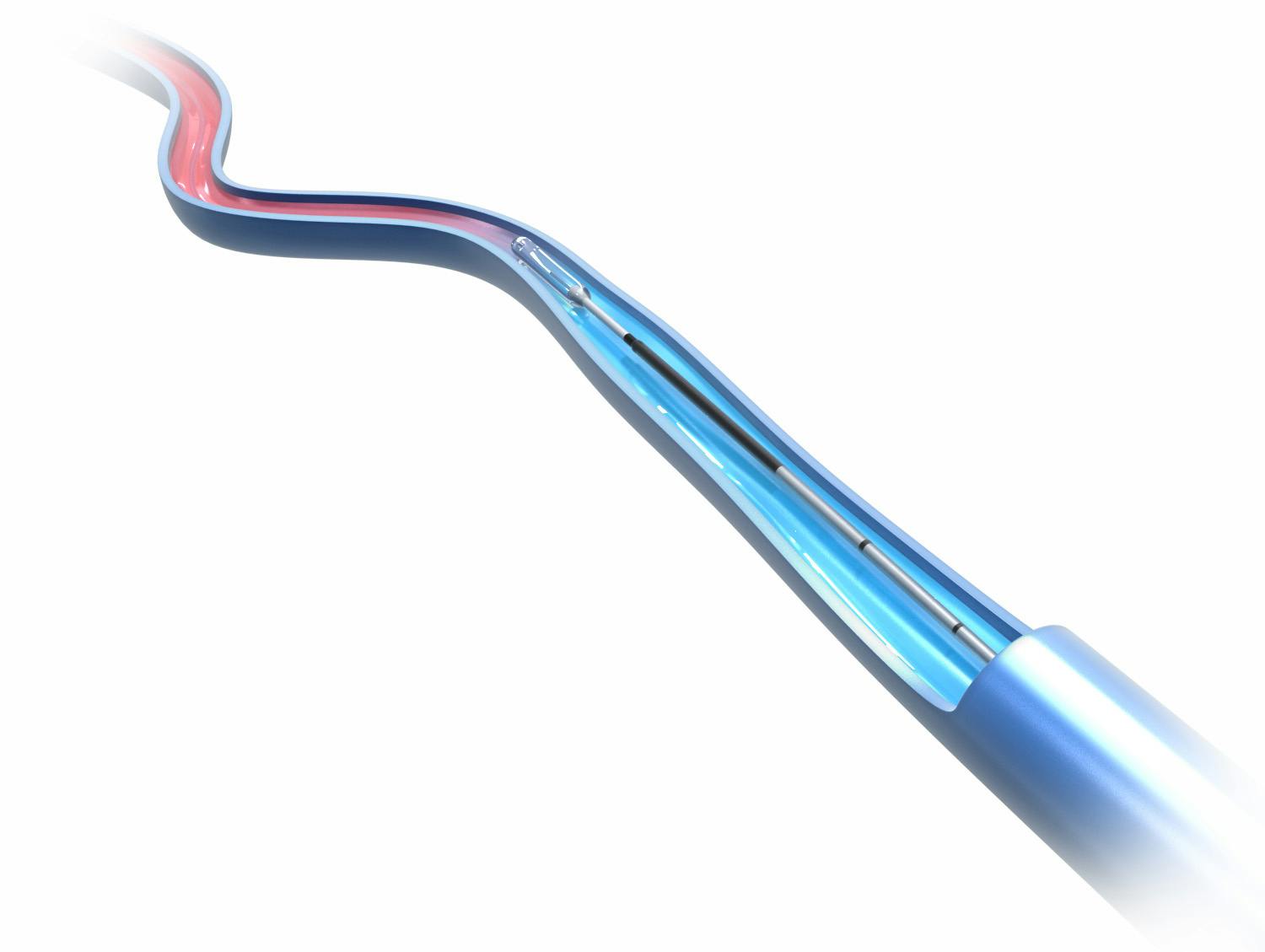 Biolitec’s Elves Radial 2ring Pro and Leonardo Laser 1940 Introduced ...