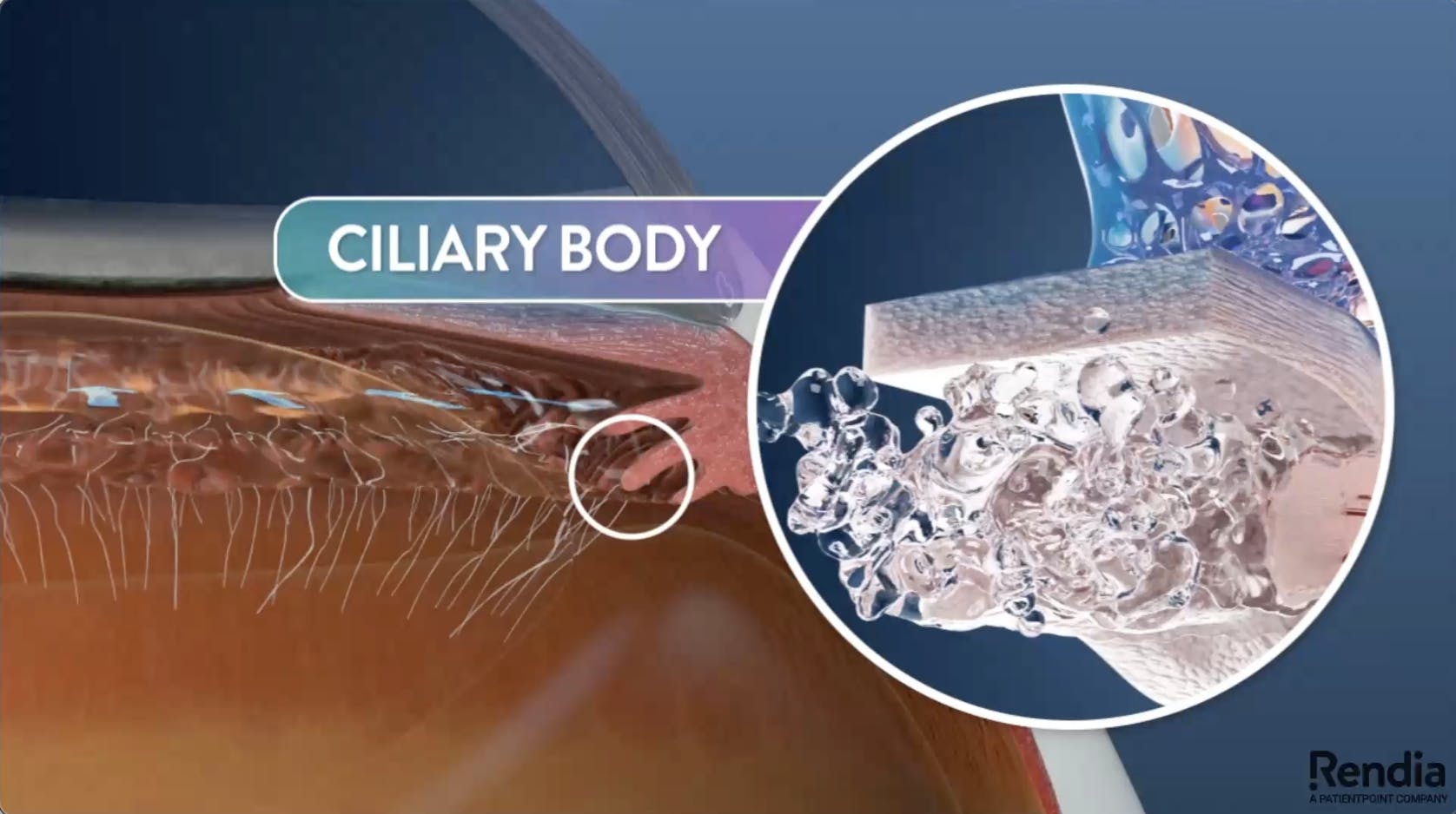 Understanding Fluid Circulation and Glaucoma - Eyetube