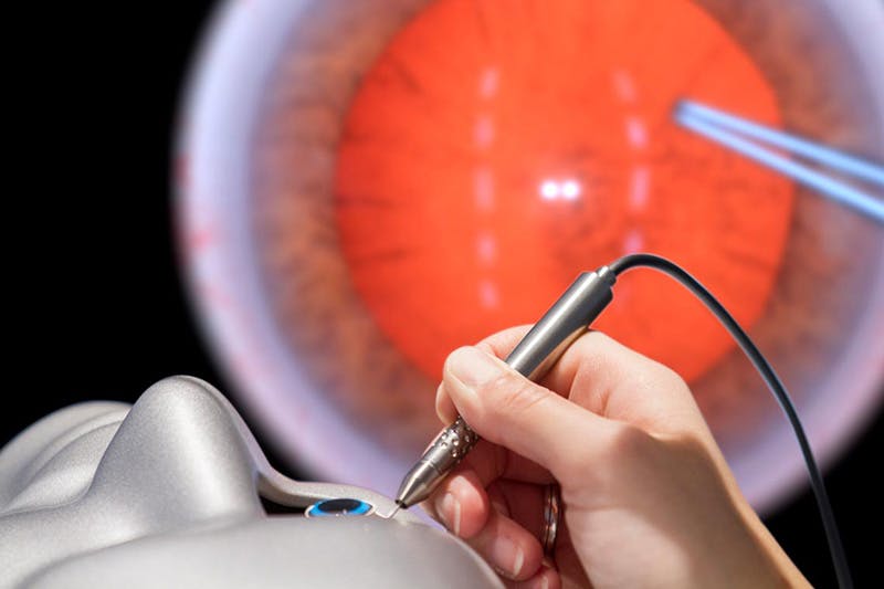 ESCRS Delegates Invited to Attend a ‘Cataract Surgery Virtual Reality ...