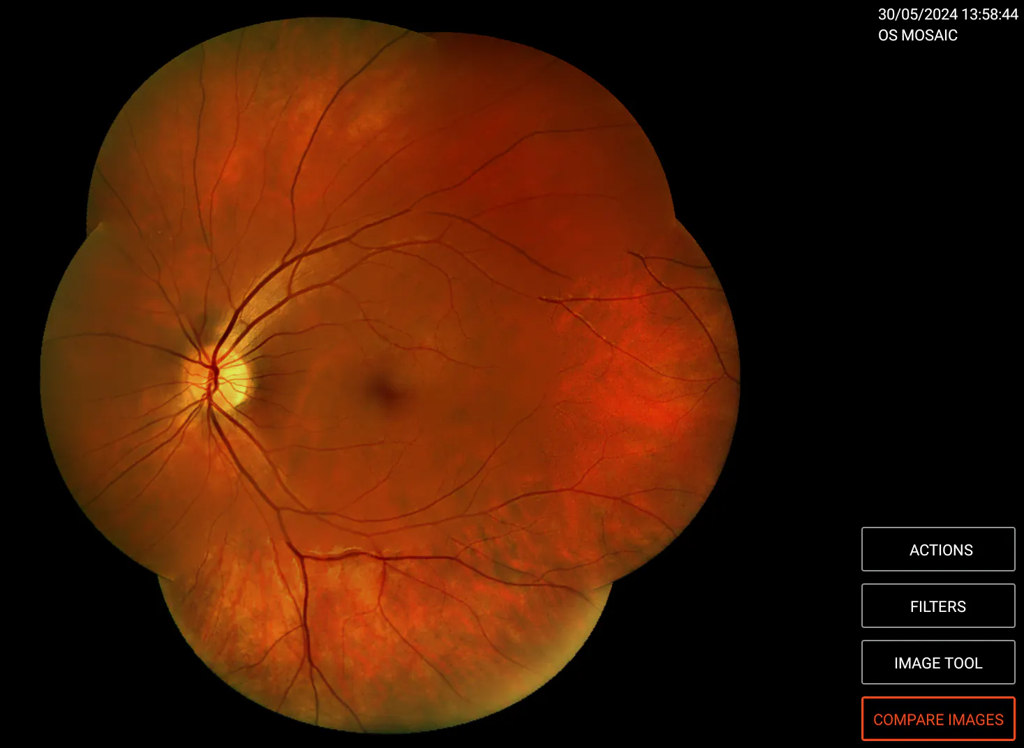 Visionix Unveils the VX 610 Automated Fundus Camera - Eyewire+