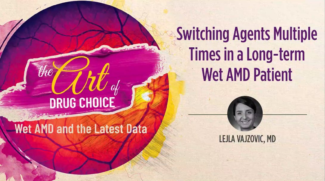 Switching Agents Multiple Times in a Long-term Wet AMD Patient - Eyetube