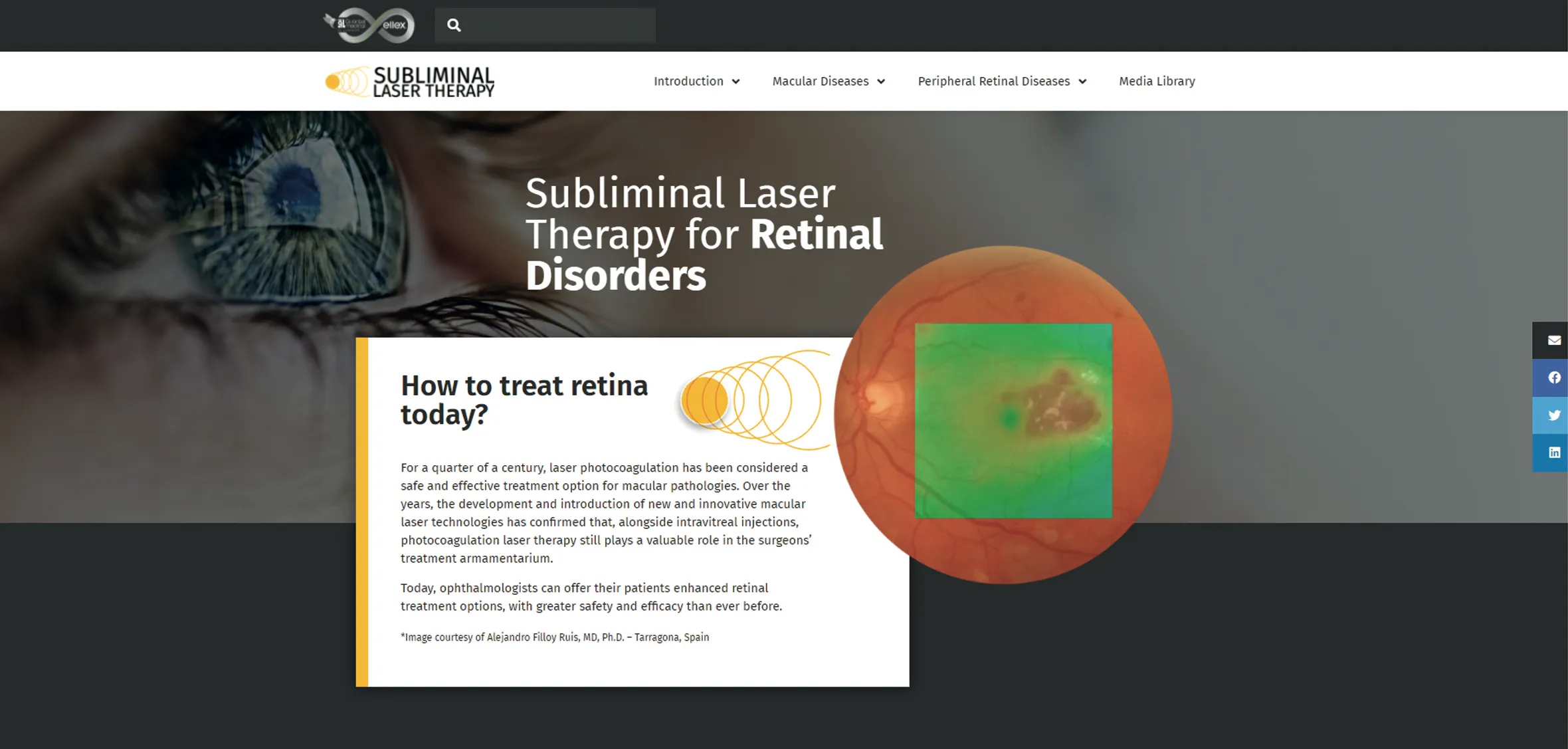 Quantel Medical Launches Website Dedicated to Laser Therapies for ...