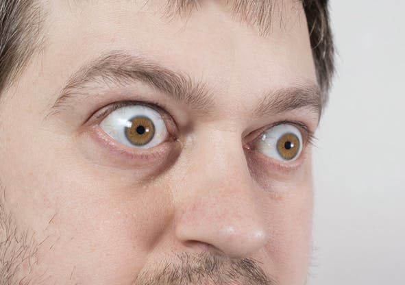 What You Need to Know to Manage TED - Modern Optometry