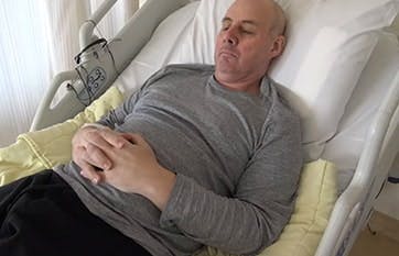 Action Myoclonus Post CAR-T - Practical Neurology