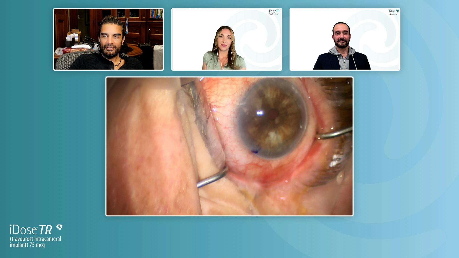 iDose TR® Live Procedure Broadcast - Eyetube