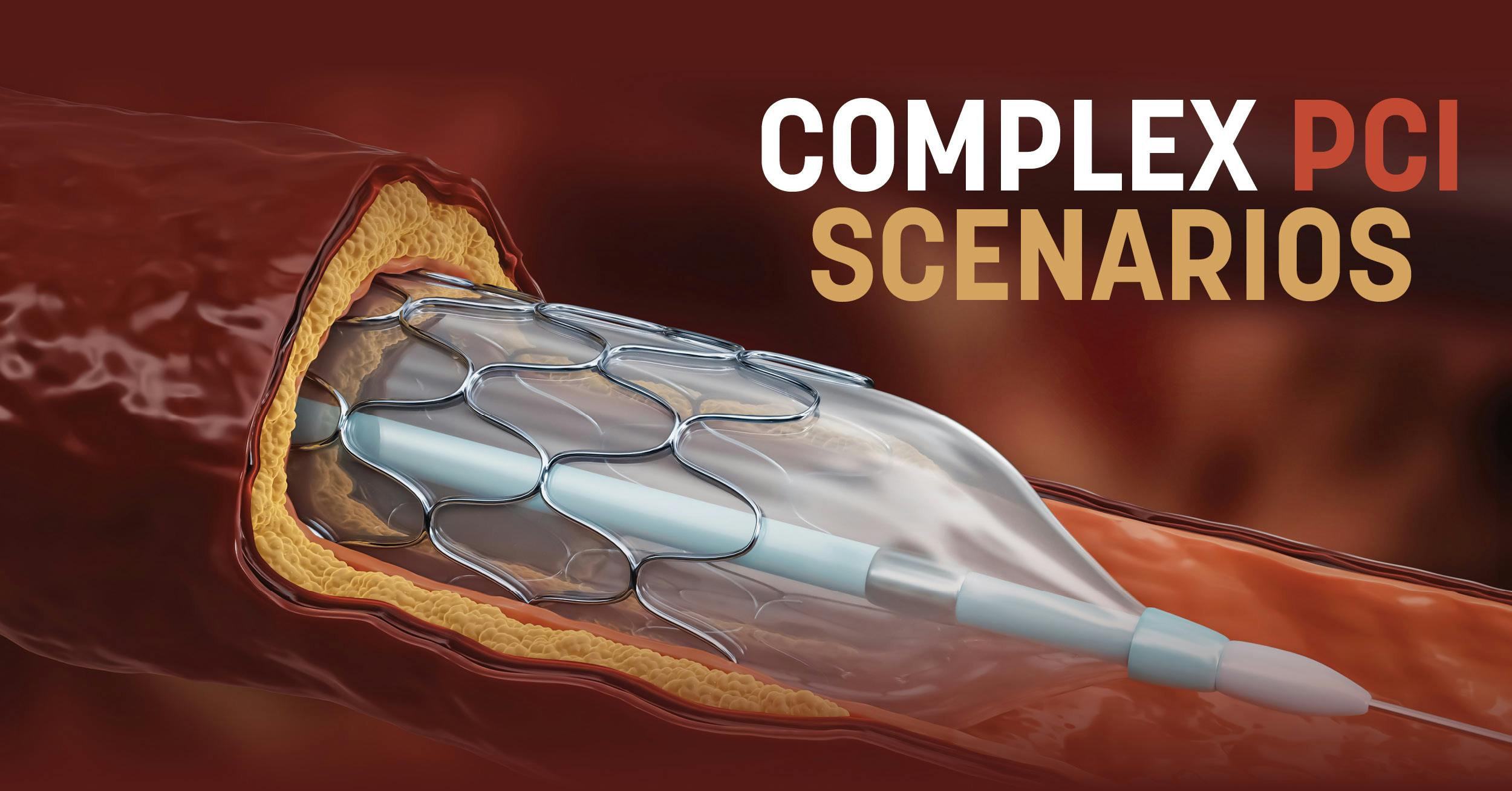 Complex PCI - Cardiac Interventions Today