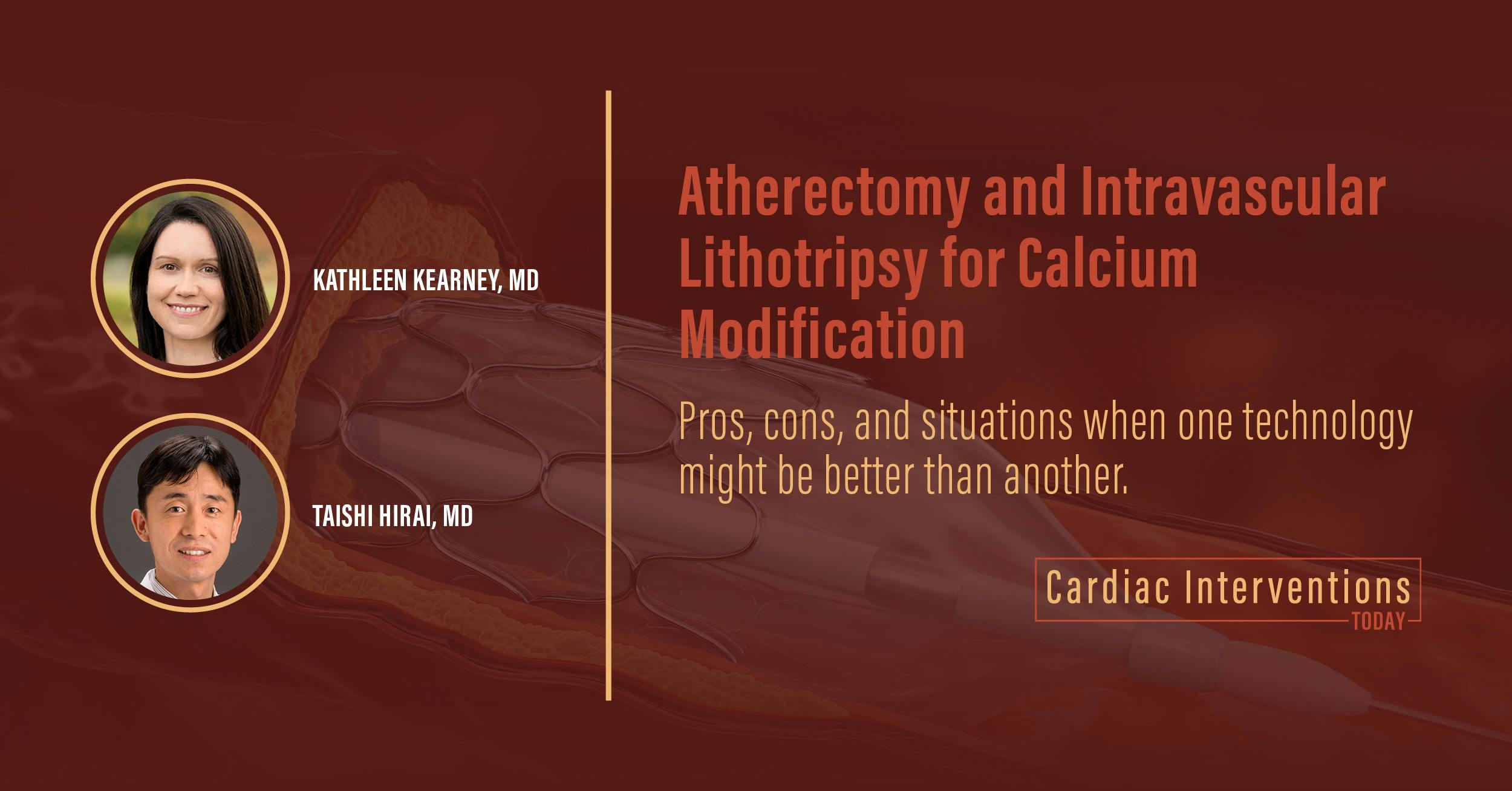 Atherectomy and Intravascular Lithotripsy for Calcium Modification ...
