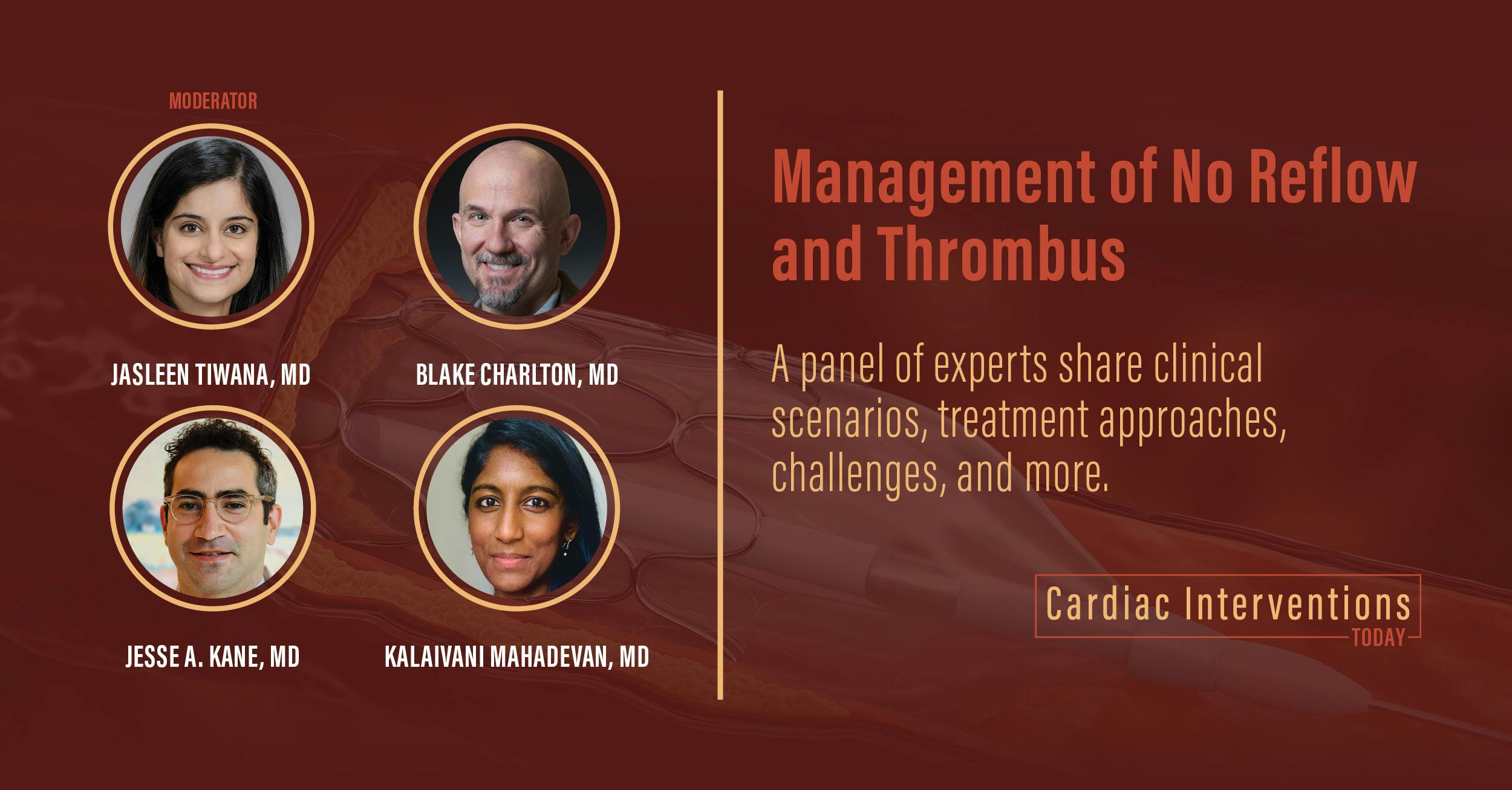Management of No Reflow and Thrombus - Cardiac Interventions Today
