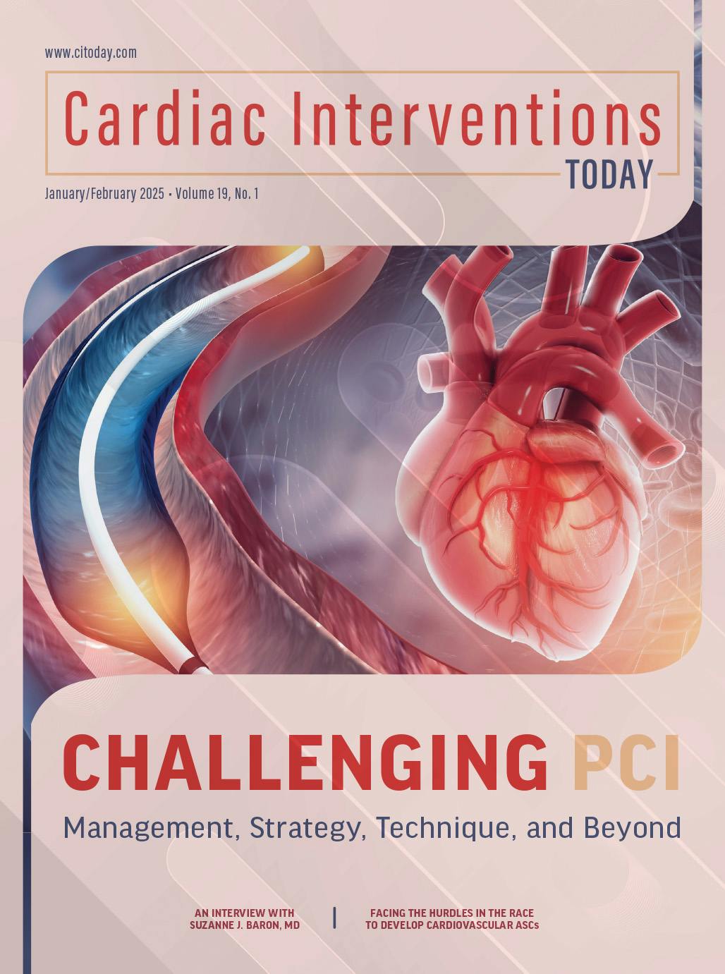 Medtronics Prevail Global Pivotal Trial Begins Patient Enrollment Cardiac Interventions Today 