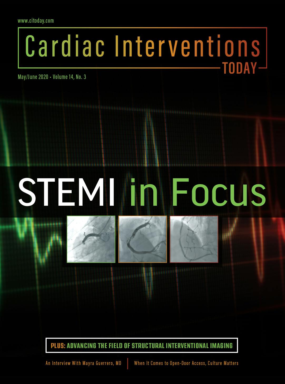 Acute and Chronic Antithrombotic Therapy in STEMI Patients Undergoing ...