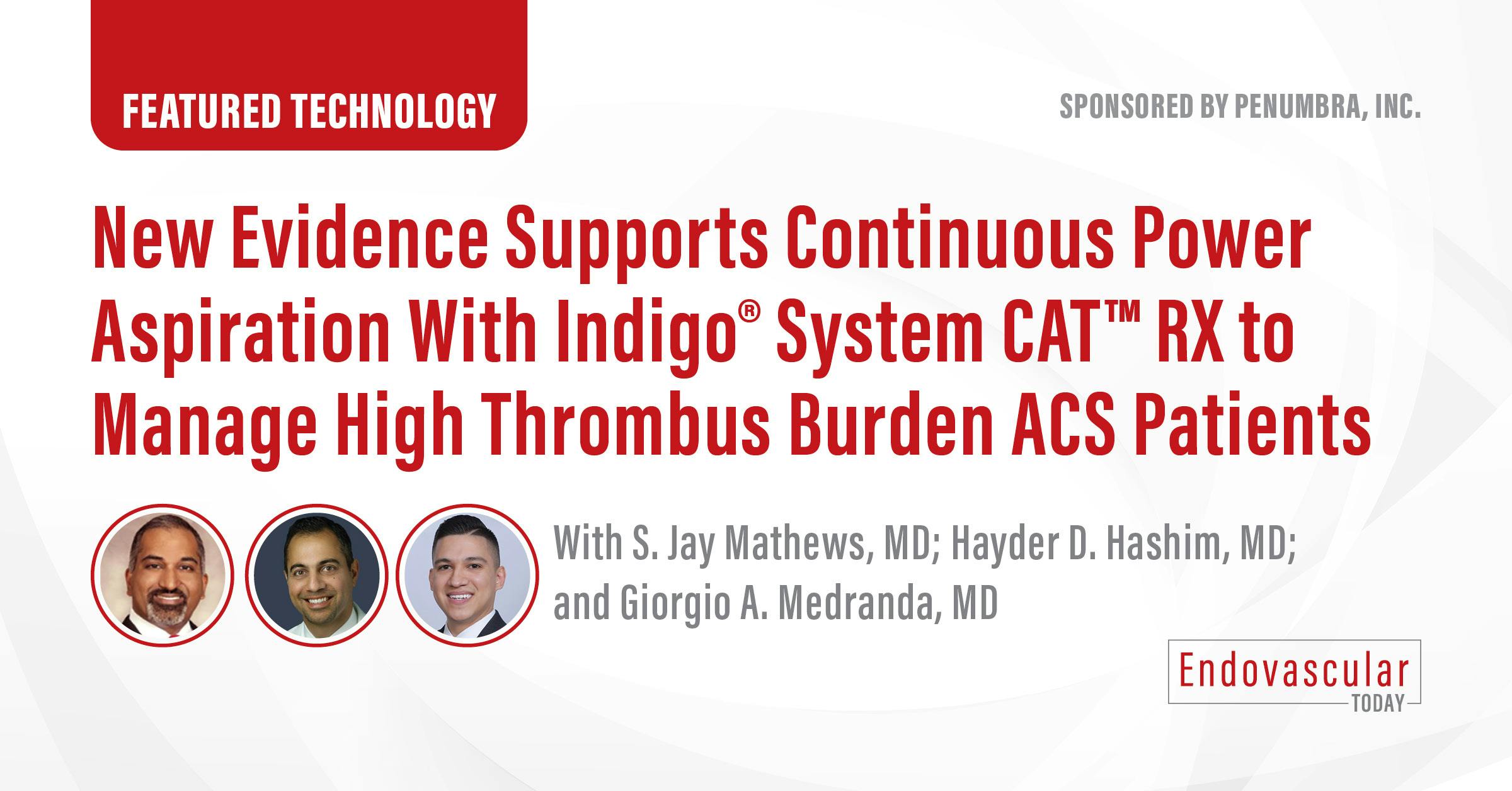 New Evidence Supports Continuous Power Aspiration With Indigo® System ...