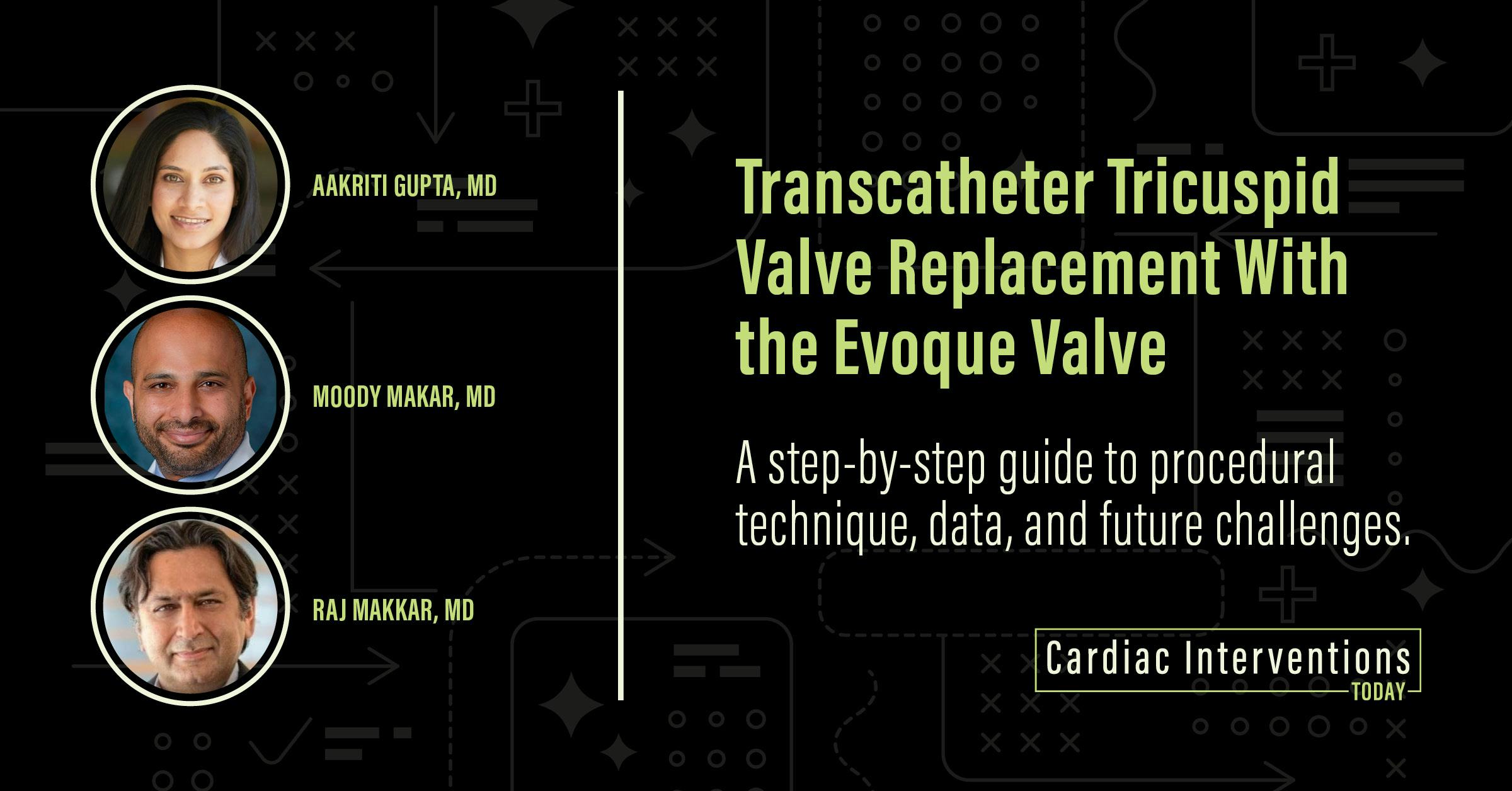 Transcatheter Tricuspid Valve Replacement With the Evoque Valve ...