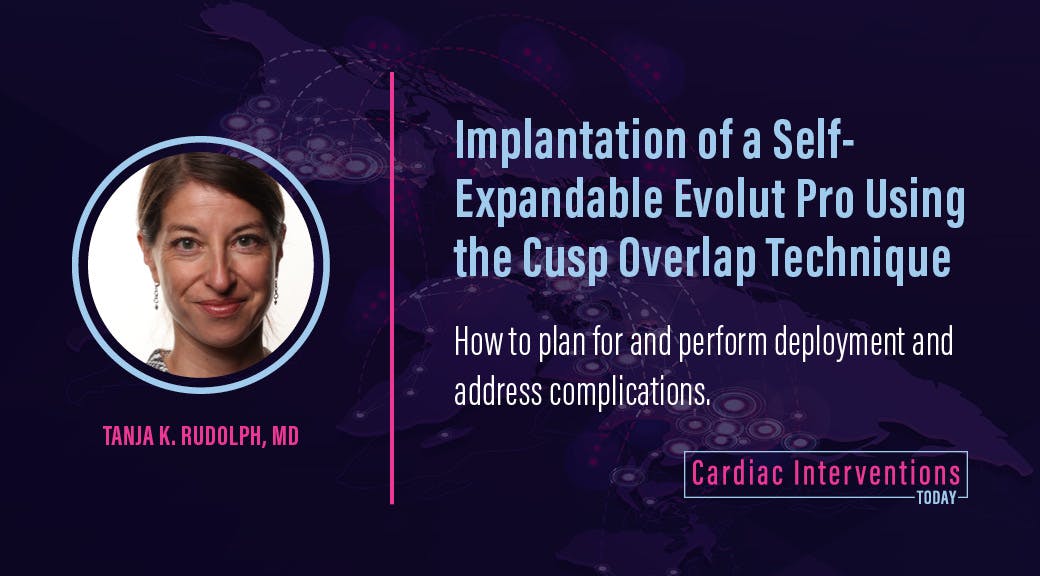 Implantation of a Self-Expandable Evolut Pro Using the Cusp Overlap ...
