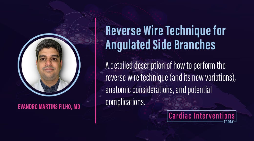 Reverse Wire Technique for Angulated Side Branches - Cardiac ...