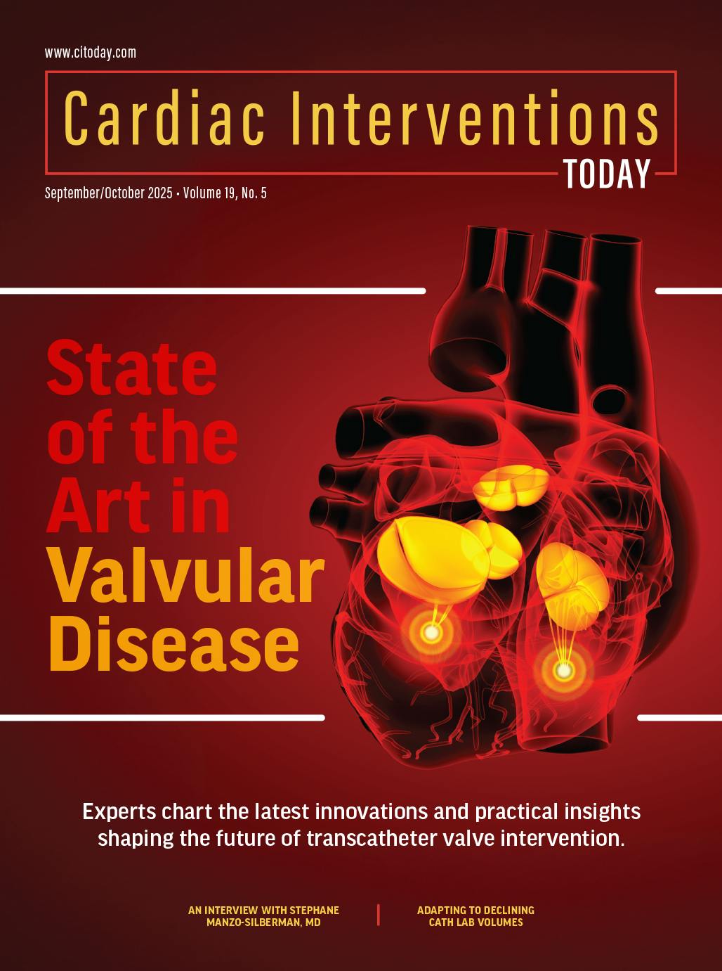 GE HealthCare Launches Vivid Pioneer Cardiovascular Ultrasound System - Cardiac Interventions Today