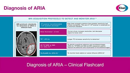 What Are Amyloid-Related Imaging Abnormalities (ARIA) and How Do They ...