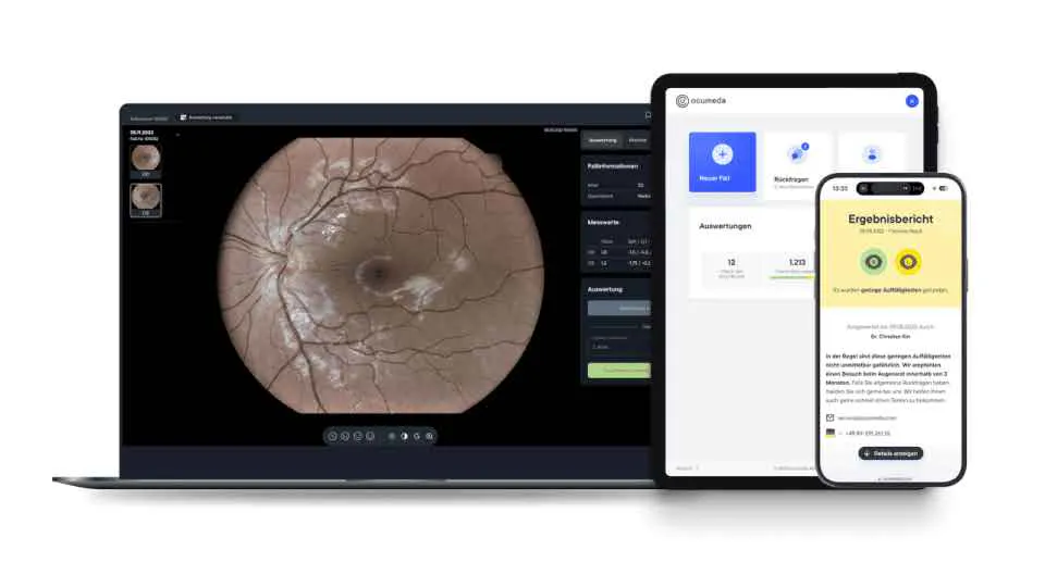 Zeiss Vision Care Acquires Stake in Switzerland-Based Ocumeda, Maker of ...