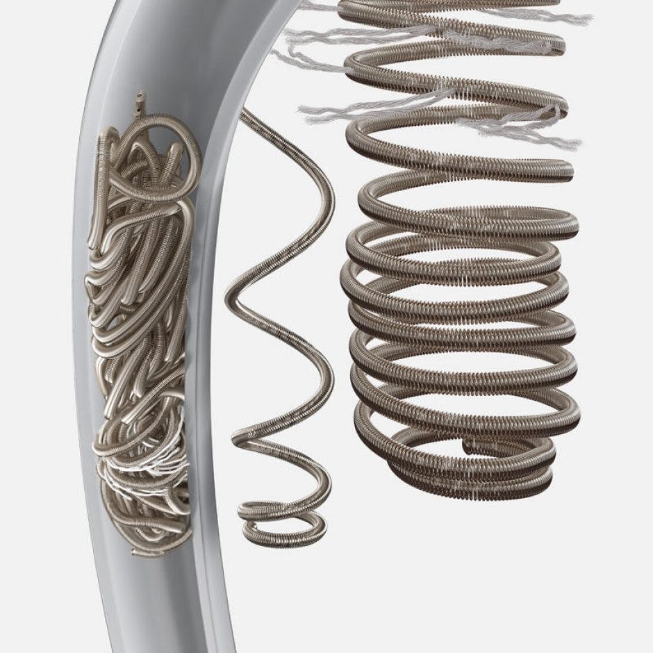 Boston Scientific’s Embold Detachable Coil System Gains CE Mark ...