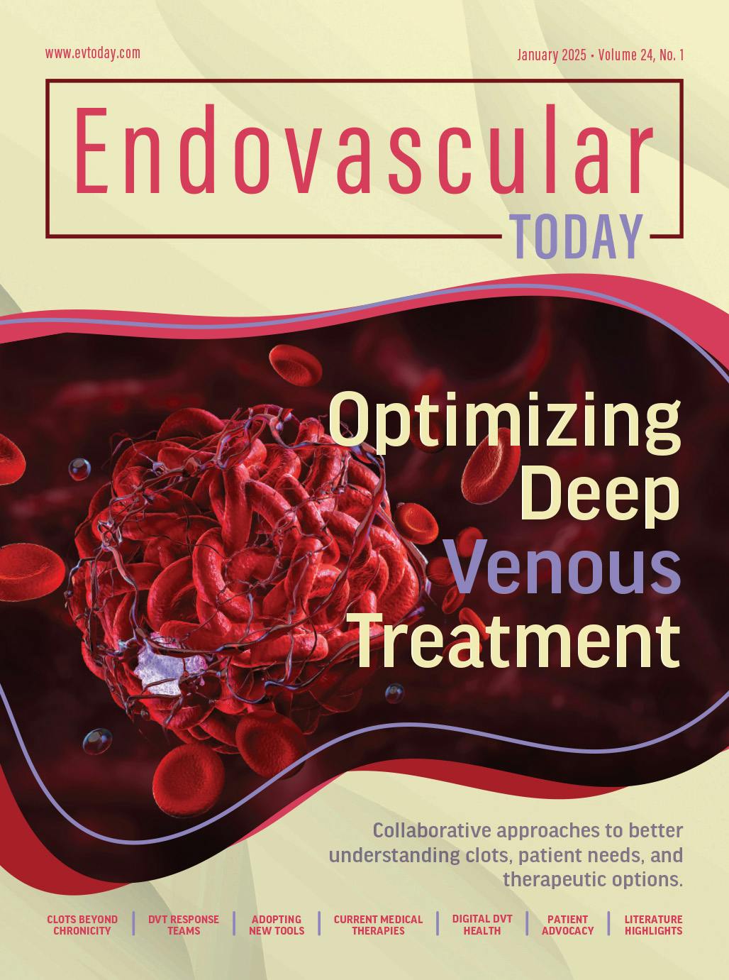 Adopting New DVT Tools: What Are the Key Questions to Ask Beforehand ...