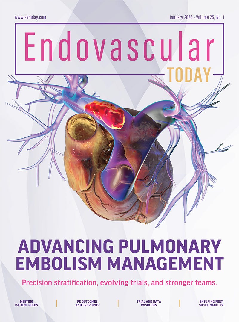 CMS Finalizes National Coverage Determination for Renal Denervation Systems - Endovascular Today