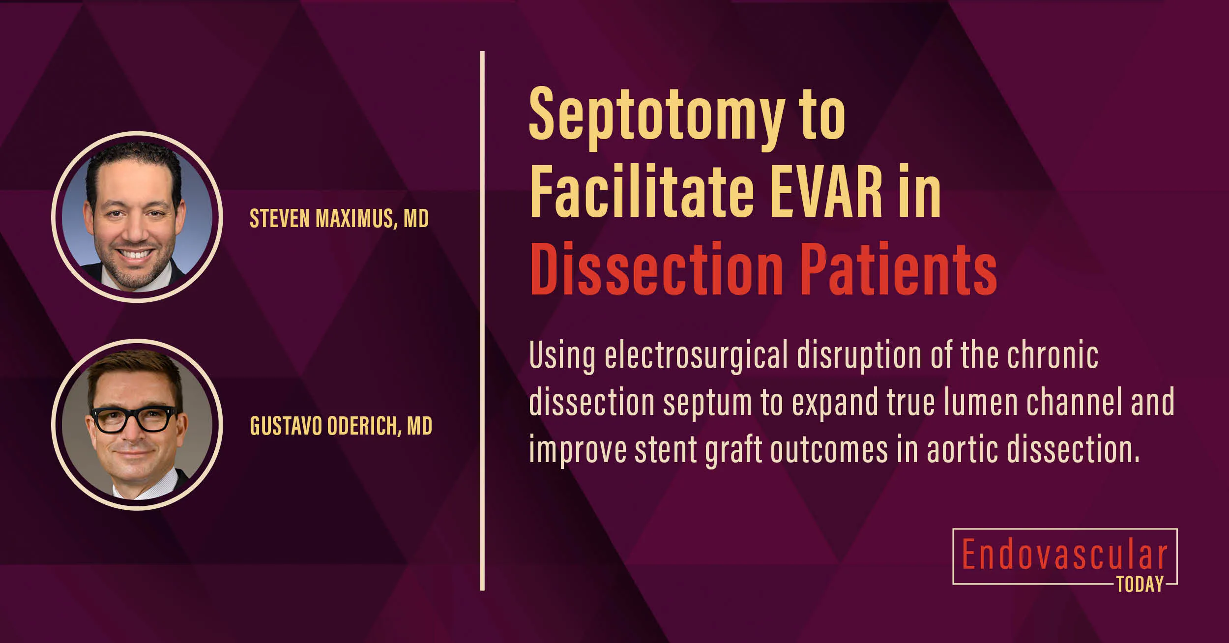 Septotomy to Facilitate EVAR in Dissection Patients - Endovascular Today