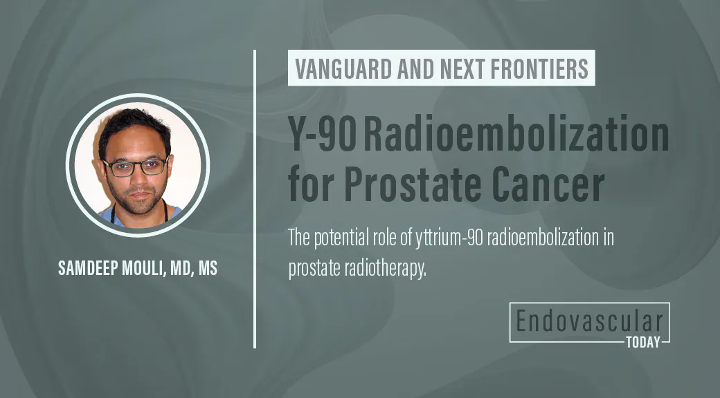 Y-90 Radioembolization for Prostate Cancer - Endovascular Today