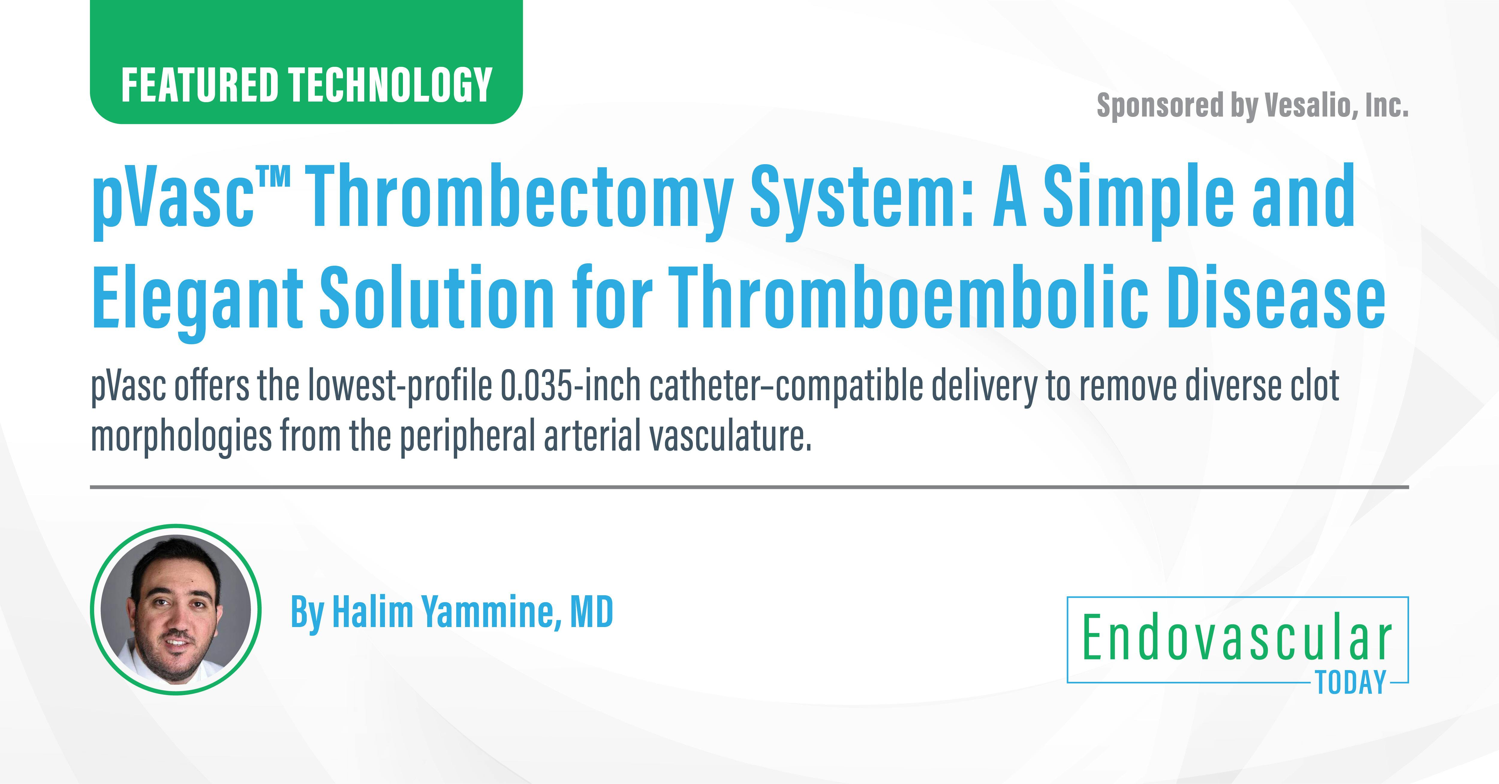 pVasc™ Thrombectomy System: A Simple and Elegant Solution for Thromboembolic Disease ...