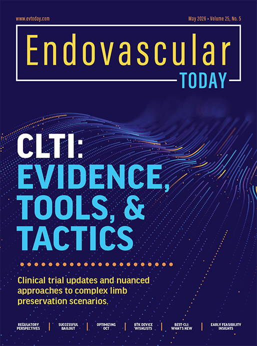C-TRACT Evaluates Endovascular Therapy to Treat Postthrombotic Syndrome ...