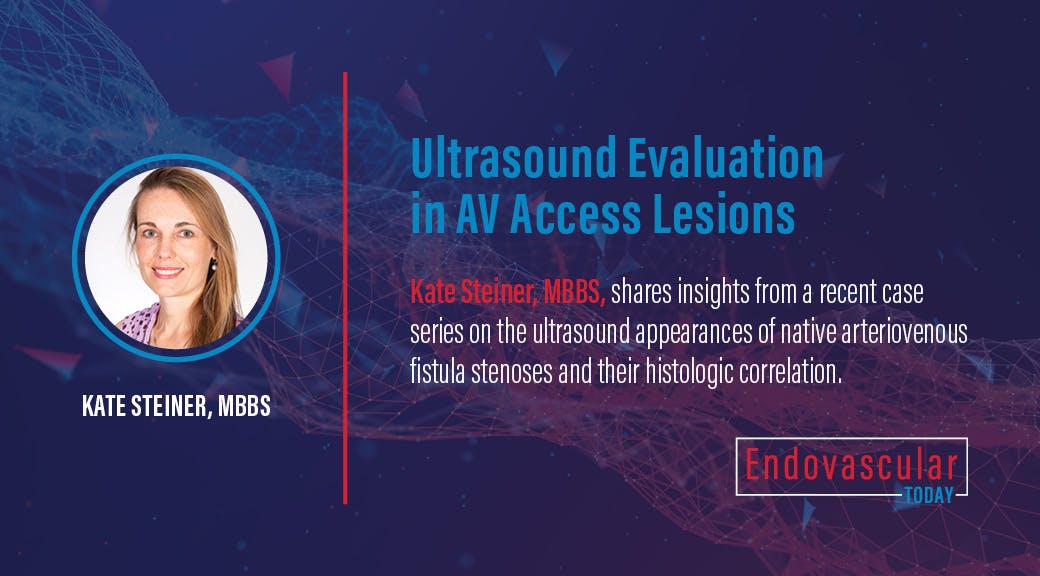 Ultrasound Evaluation in AV Access Lesions - Endovascular Today