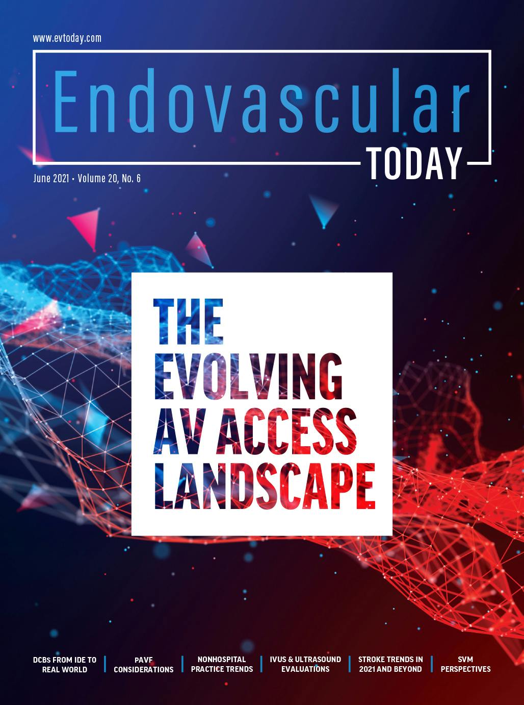 Ultrasound Evaluation in AV Access Lesions - Endovascular Today